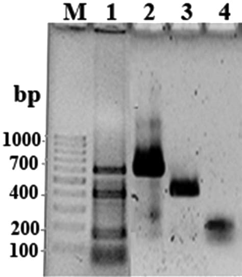 The Multiplex Pcr Results Lanes 2 4 Uniplex Pcr Of Some Download Scientific Diagram