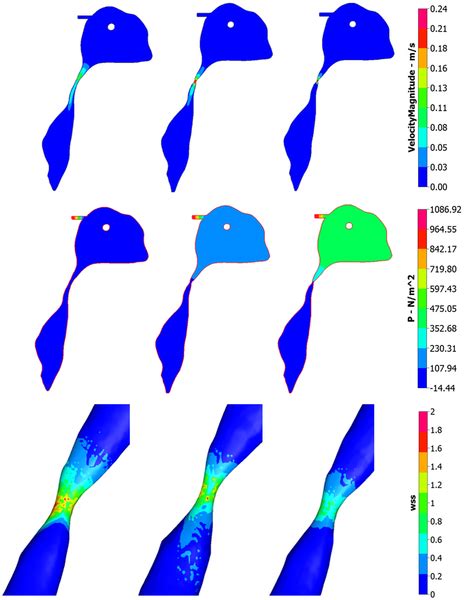 Ventriculostomy Plos One
