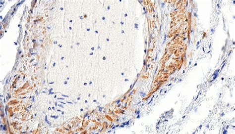 Smooth Muscle Marker Antibody Duo Desmin Sma Arg30051 Arigo Biolaboratories