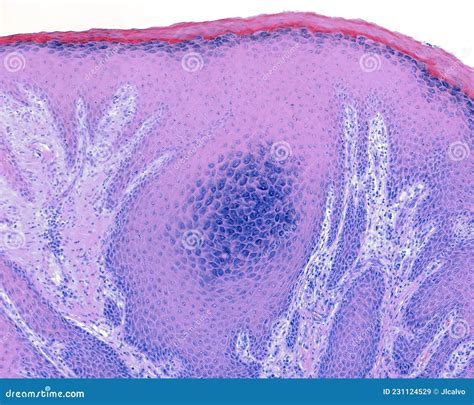 Hpv And X28 Human Papillomavirusand X29 Acronym Word Made Of Square Letter Word On Pink Background