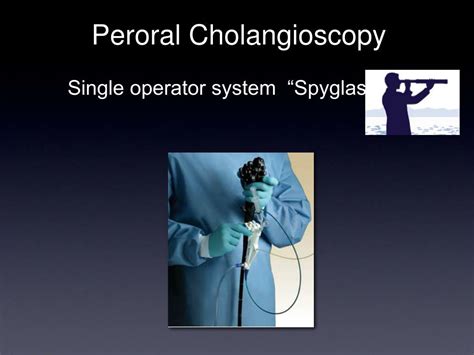 Ppt Cholangioscopy Powerpoint Presentation Free Download Id3430087