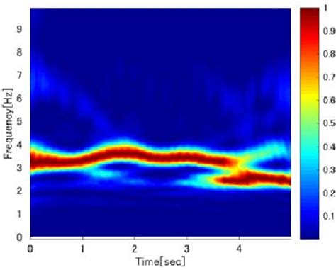 Figure 1 From A Recognition Algorithm For Electrocardiogram Based On Wavelet Transform And