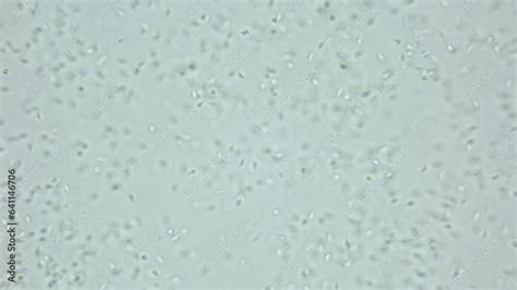 Sperm Sea Urchin Strongylocentrotus Pallidus Under Microscope Phylum