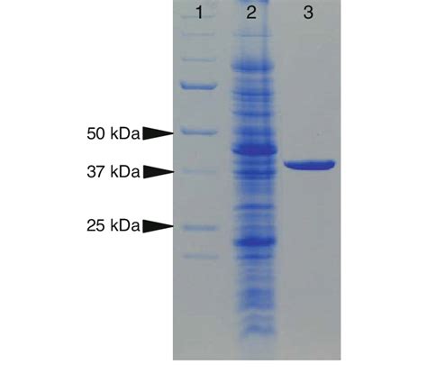 Sds Page Of Recombinant L Plantarum Esterase Purification By Ni Nta Download Scientific