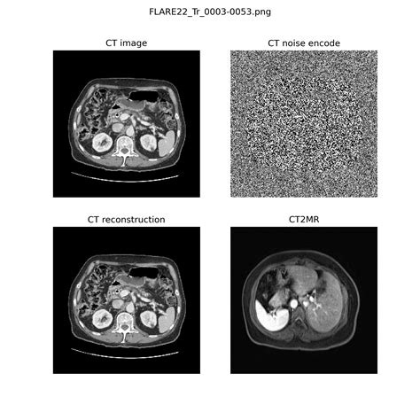 Train The Unpaired Image To Image Translation On One Gpu Issue Chenwu Cycle Diffusion