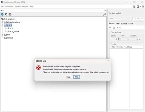 Ct2mri Causes Error Undefined Function Histogramparzen Bugs