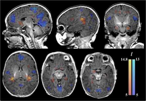 Functional Structure Of Local Connections And Differentiation Of Cerebral Cortex Areas In The