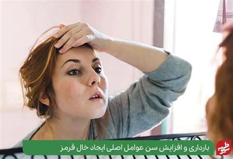 خال قرمز نشانه‌ای از سرطان یا بدون خطر است؟ در سیوطب بخوانید