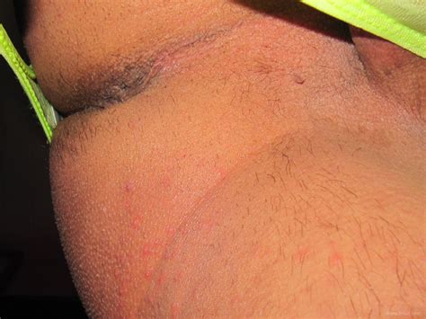 Daily Sex Every Day Makes The Doctor Away