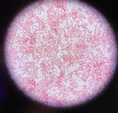 Endospores Under Microscope Endospores Under Microscope