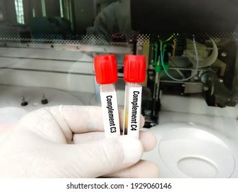 65 Complement Disorders Royalty Free Images Stock Photos Pictures Shutterstock