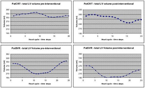 Total LV Volume The Diagrama Show The Total LV Volume For PatCRT Download Scientific Diagram