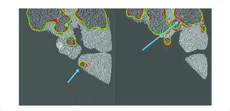 Green Contour Shows The Predicted Results By S Net Models While Red