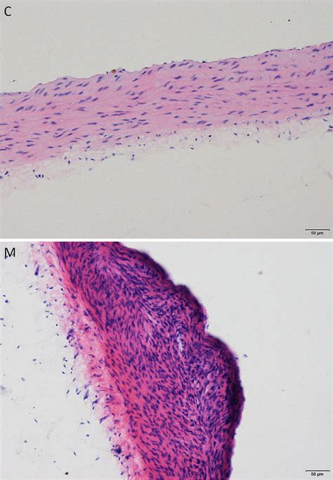 The Morphology Of Aorta By He Staining Download Scientific Diagram
