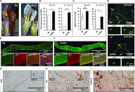 Aav Delivery Via Bilateral Sciatic Nerve Direct Immersion Scindi In