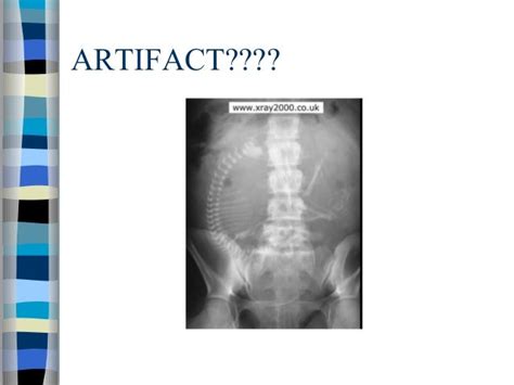 Artifact