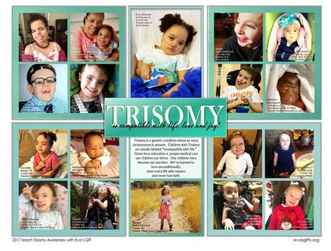 Trisomy 9 Mosaic Added A New Photo Trisomy 9 Mosaic