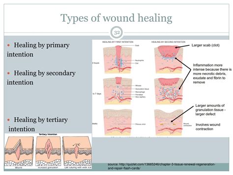 What Are The 3 Types Of Wound Healing At Priscilla Carollo Blog