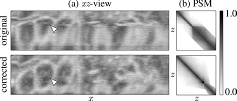 Fib Sem Series Before Top And After Bottom Section Thickness