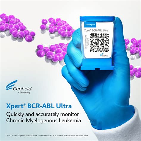 Fatima Ali On Linkedin Cml Genexpert