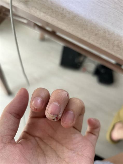 잡담 앞으로 넘어지면서 손으로 바닿 짚어서 ㅎㅇㅈㅇ 인스티즈instiz 일상 카테고리