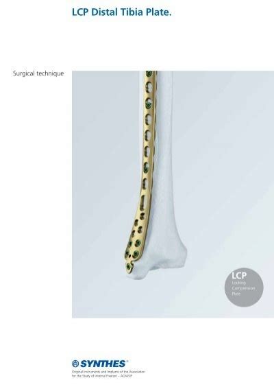 Lcp Distal Tibia Plate