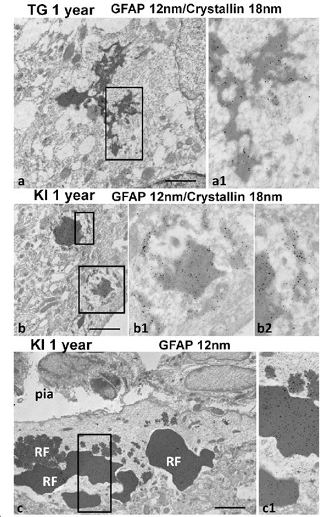 Immunogold Staining Of Rfs A B Double Immunogold Staining For