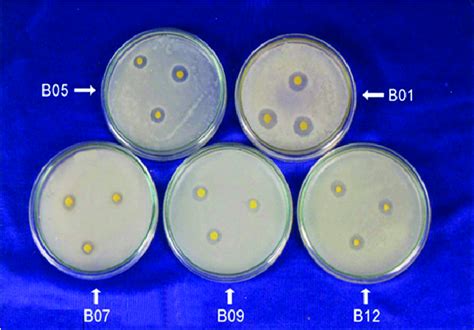4 Disk Diffusion Test Of Savlon Loaded Pvaalginate Hydrogel