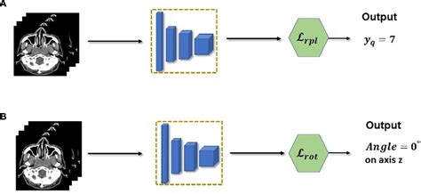 Figure 3 From Automatic Segmentation Of Nasopharyngeal Carcinoma On Ct Images Using Efficient