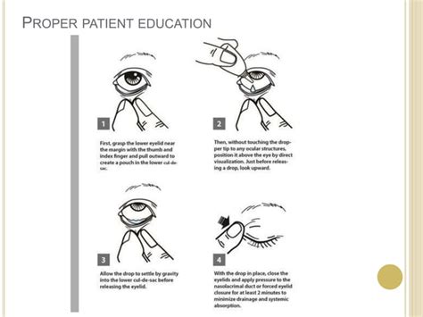 Glaucoma Types Pathogenesis Diagnosis And Treatment Pptx