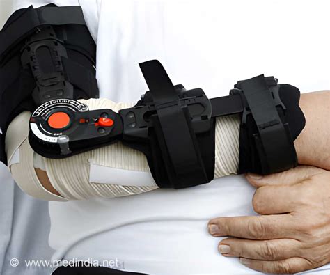 Unlock The Power Of Wearable Tool To Treat Hand Edema