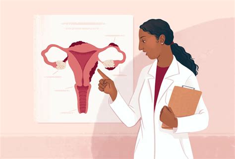 Causes Of Endometriosis