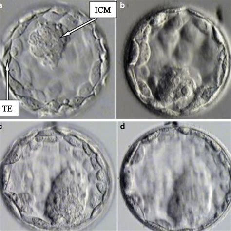 Research On Embryo Grading System Download Scientific Diagram