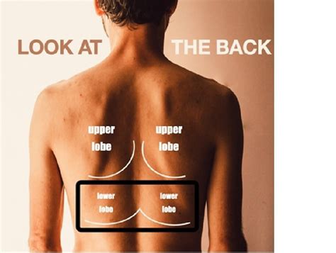 Ultrasound Of The Month Can You Use Pocus For Pneumonia — Downeast Emergency Medicine