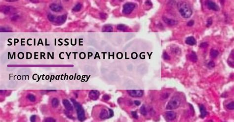 Cytopathology List Of Issues Wiley Online Library