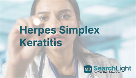 Herpes Simplex Keratitis Md Searchlight