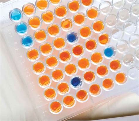 Dilutional Linearity Parallelism Spike And Recovery In Elisa How To Qc Your Results Enzo