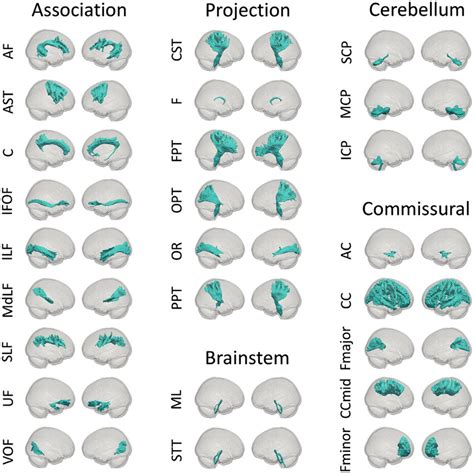 Major Fiber Bundles Of The Iit Human Brain Atlas V50 Download Scientific Diagram