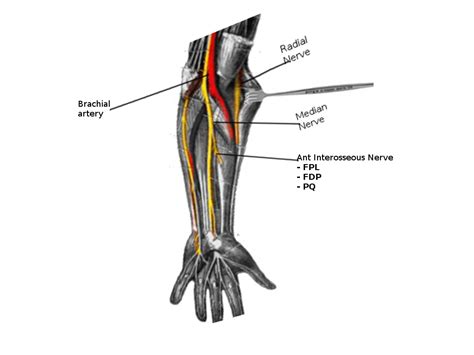 Anterior Interosseous Nerve Pronator Syndrome Surgery And Treatment