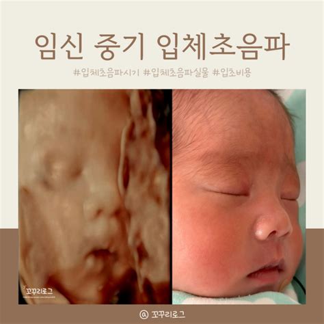 임신 28주 29주 입체 초음파 시기 얼굴 재검 비용 실물 비교 네이버 블로그 임신 28주 29주 입체 초음파 시기 얼굴 재검 비용 실물 비교 네이버 블로그