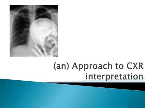 Ppt An Approach To Cxr Interpretation Powerpoint Presentation Free Download Id2048554