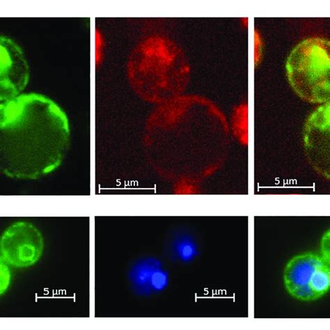 Localization Of The Slzrt2egfp Fusion Protein In Yeast A Fm4 64