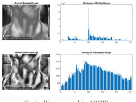 Figure From An Appropriate Histogram Equalization Technique For Thermal Image Enhancement Of