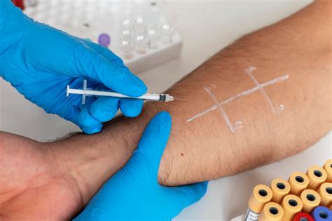 What Can Different Allergy Tests Tell You About Your Health