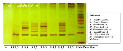 Visualization Of Str Codis Pcr Product Using At Locustho1 156 195 Bp Download Scientific