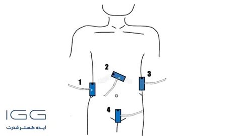 استفاده از سونوگرافی در طب اورژانس ایده گستر قدرت