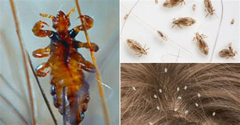 Head Lice Screening BIS Newsletter