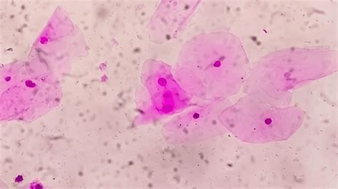 Why Is There A Placebo Week In Birth Control Its Not What Youd Think