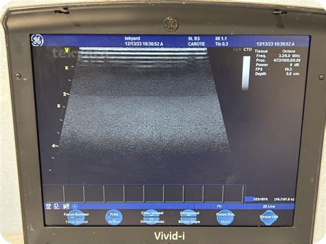 Used Ge 9l Rs Linear Array Probe Ultrasound Transducer For Sale Dotmed Listing 4793979