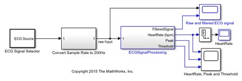 Real Time Ecg Qrs Detection On Arm Cortex A Processor Matlab